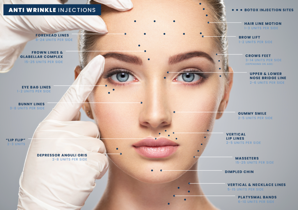 Cosmetic and Therapeutic Injectables - Alcaston Dental Care
